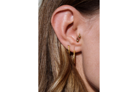 Comment faire pour se débarrasser d'une chéloïde